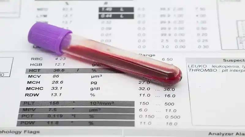 Low MCHC: Blood Test Results, Symptoms, and More