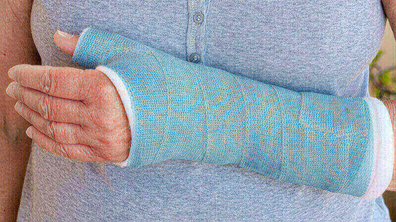 Fracture Casting: The Procedure You Need for Broken Bones | Narayana Health